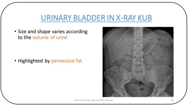 X RAY KUB 2 | PDF