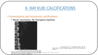 X RAY KUB 2 | PDF