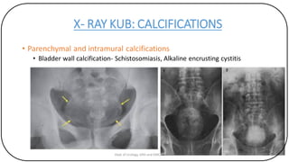 X RAY KUB 2 | PDF