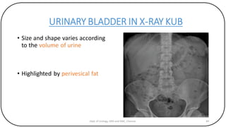 X RAY KUB 2 | PPT