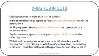 X RAY KUB 2 | PPT