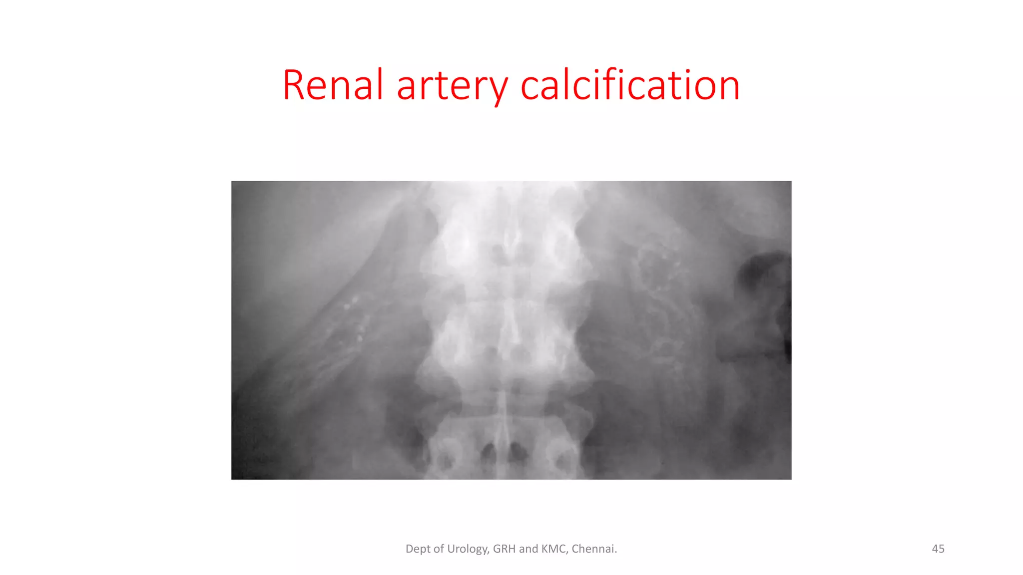 X RAY KUB 1 | PDF | Digestive Disorders | Diseases and Conditions