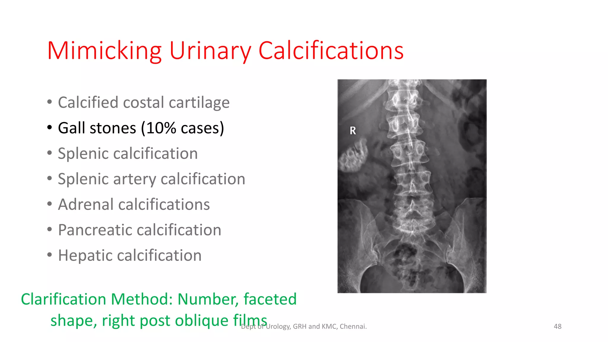 X RAY KUB 1 | PDF