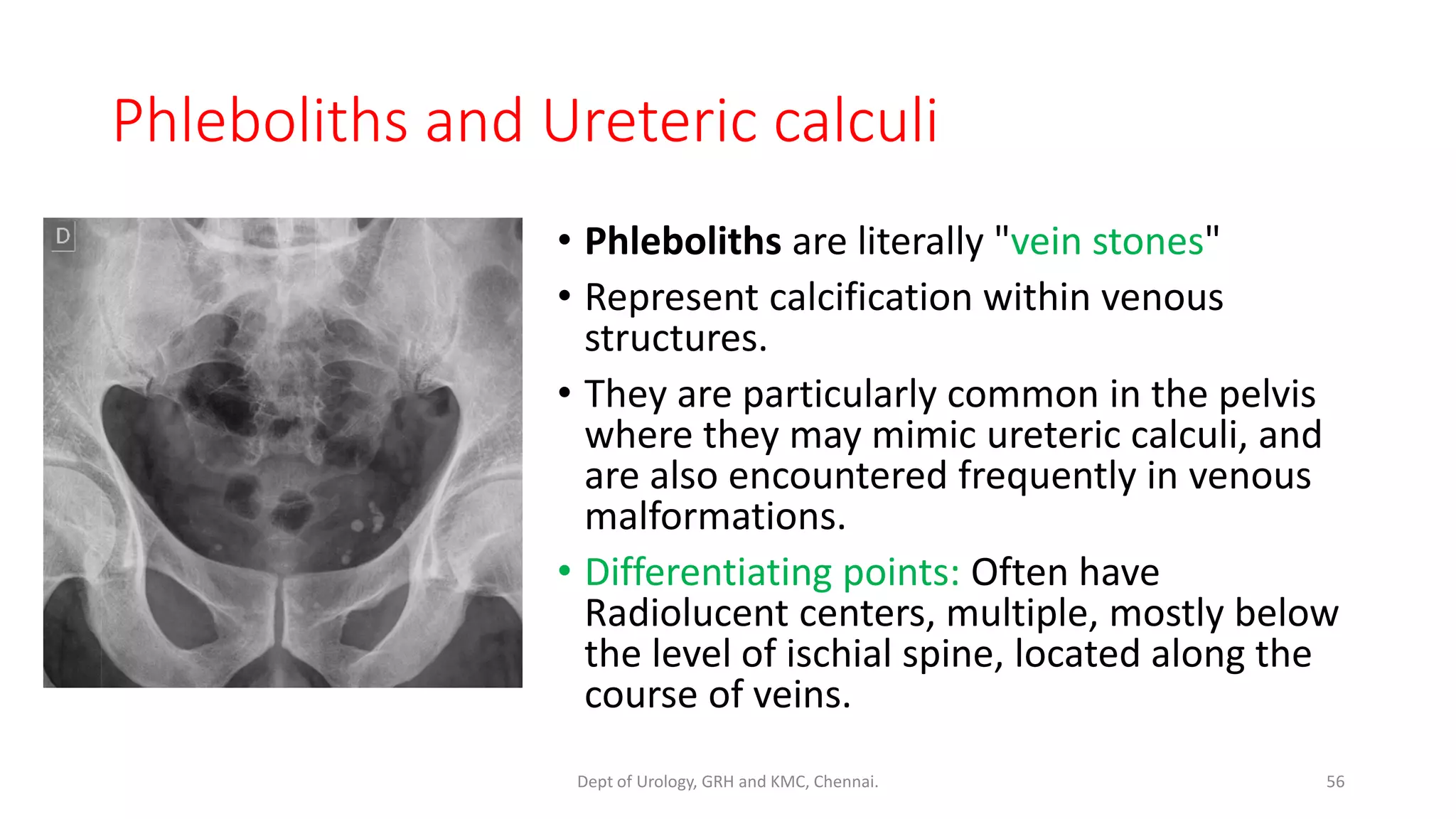 X RAY KUB 1 | PDF