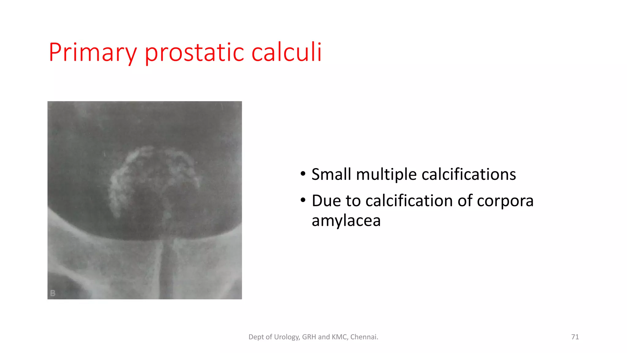 X RAY KUB 1 | PDF