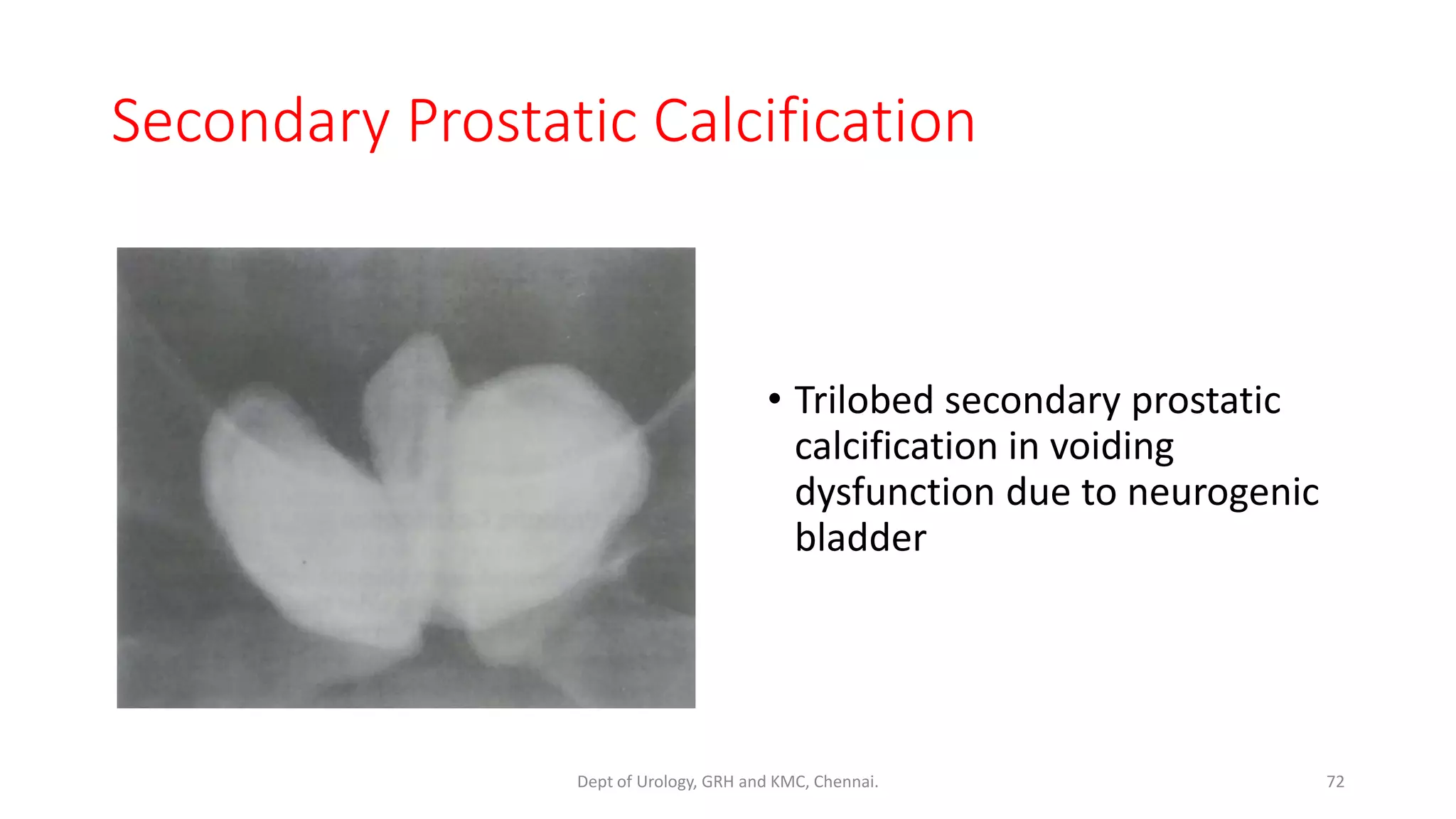 X RAY KUB 1 | PDF