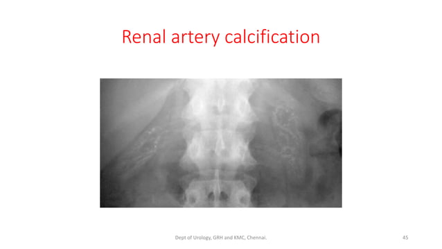 X RAY KUB 1 | PDF | Digestive Disorders | Diseases and Conditions