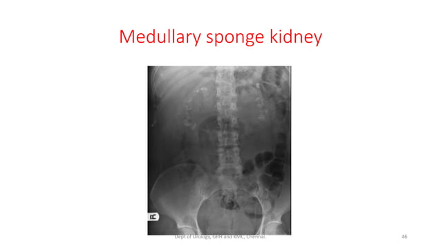 X RAY KUB 1 | PDF | Digestive Disorders | Diseases and Conditions