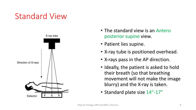 X RAY KUB 1 | PDF | Digestive Disorders | Diseases and Conditions