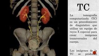 URO-TC | PPTX