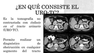 URO-TC | PPTX