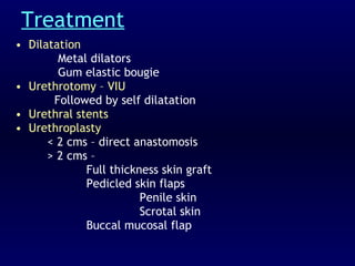 Uro Urethral Stricture | PPT