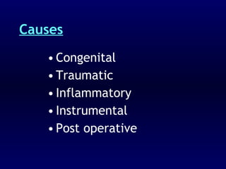Uro Urethral Stricture | PPT