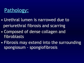 Uro Urethral Stricture | PPT