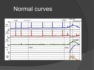 Urodynamics | PPTX