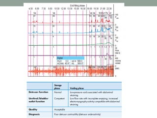 ppt on Urodynamics | PPT
