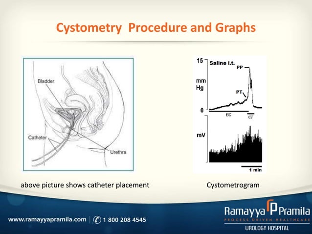 Urodynamics /Uroflowmetry | PPTX | Lung and Respiratory Health ...