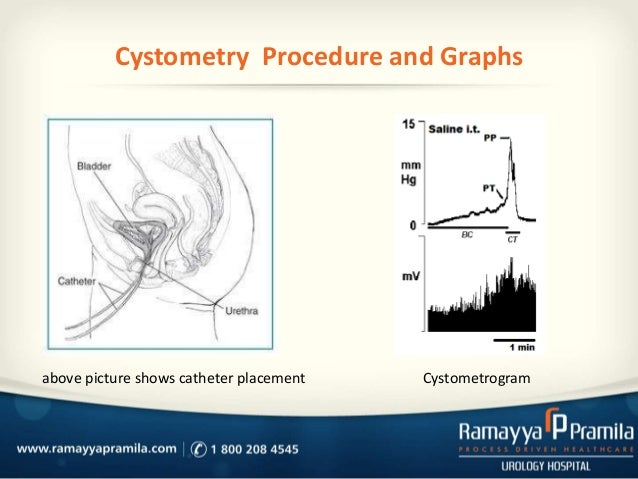 Urodynamics /Uroflowmetry