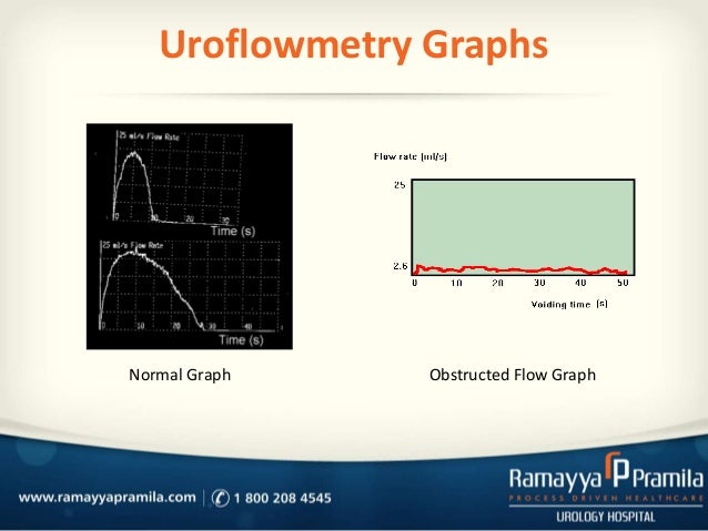 Urodynamics /Uroflowmetry