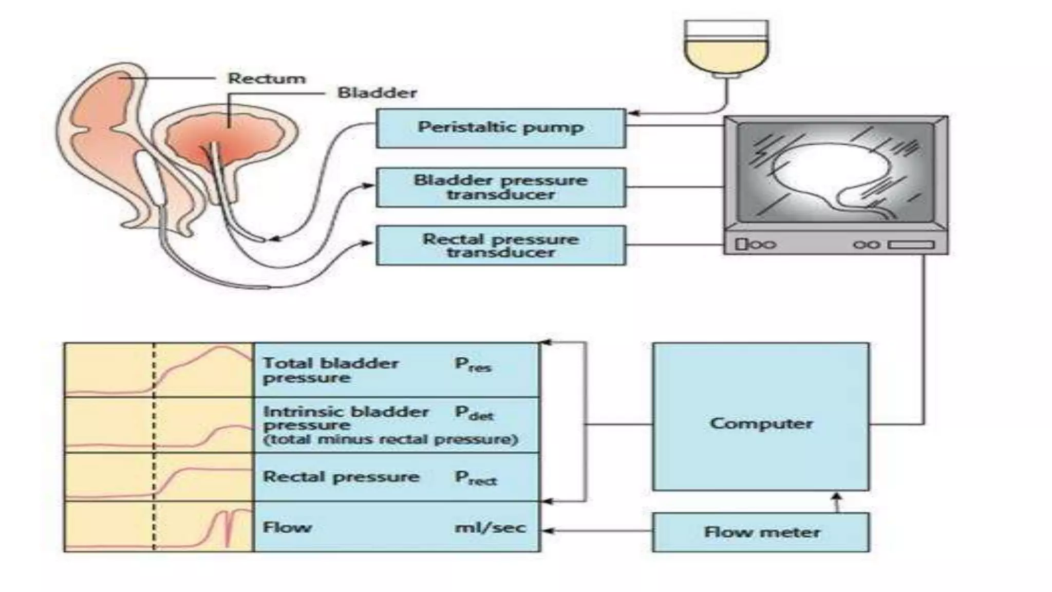Urodynamic Testing Pptx
