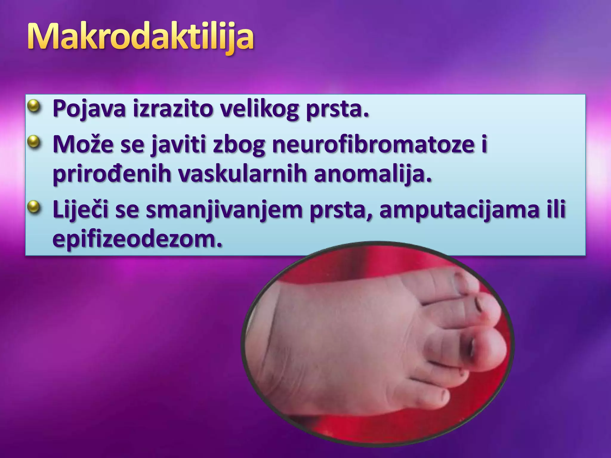 Urođene anomalije donjih udova | PPSX