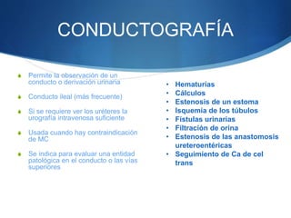 Diagnóstico por imagen Urología | PPTX