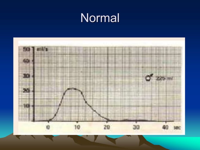 Uroflowmetry | PPTX | Medical Health