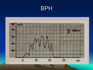 Uroflowmetry | PPTX