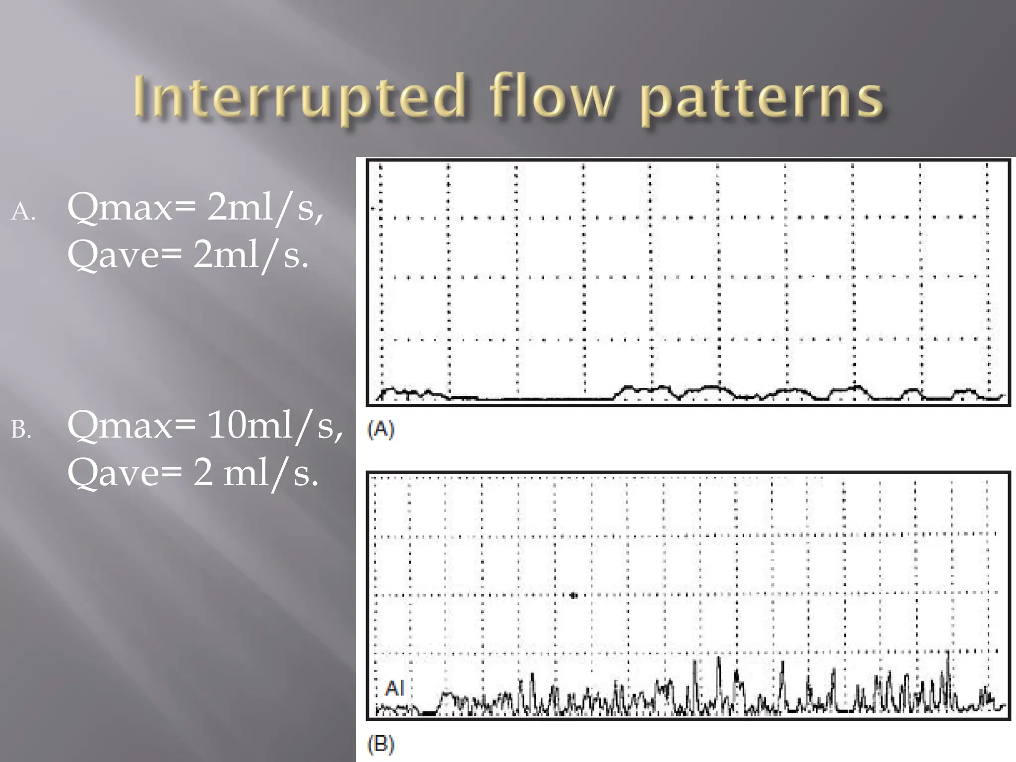 Uroflowmetry Assiut university presentation | PDF