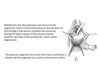 Urogenial sinus and vagial atresias | PPTX
