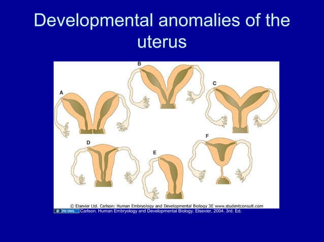 Urogenital embryology | PPT