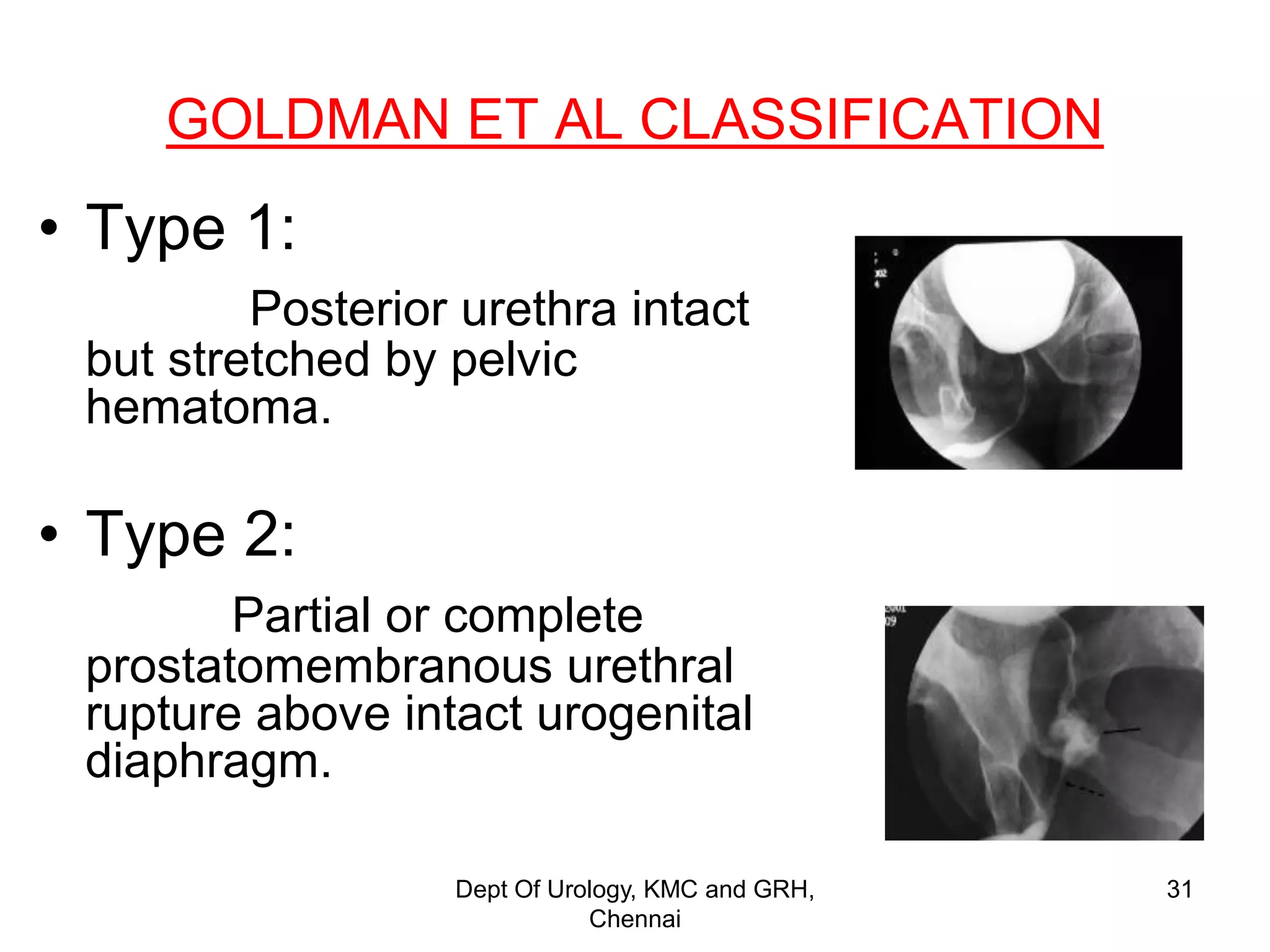 Urogenital triangle | PDF