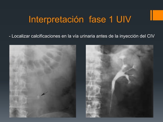 Urografía IV- TC Urografía. Técnica e indicaciones. | PPTX