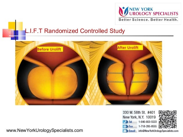 Urolift System For Treatment Bph And Enlarged Prostate