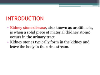 Urolithiasis | PPTX