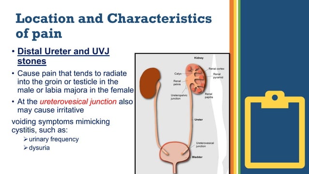 Urolithiasis