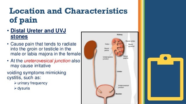 Urolithiasis