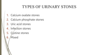 UROLITHIASIS.pptx