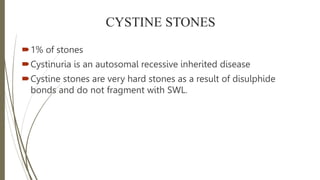 UROLITHIASIS.pptx