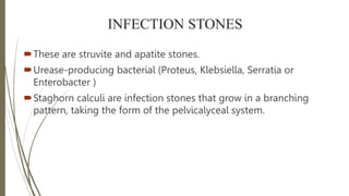 UROLITHIASIS.pptx