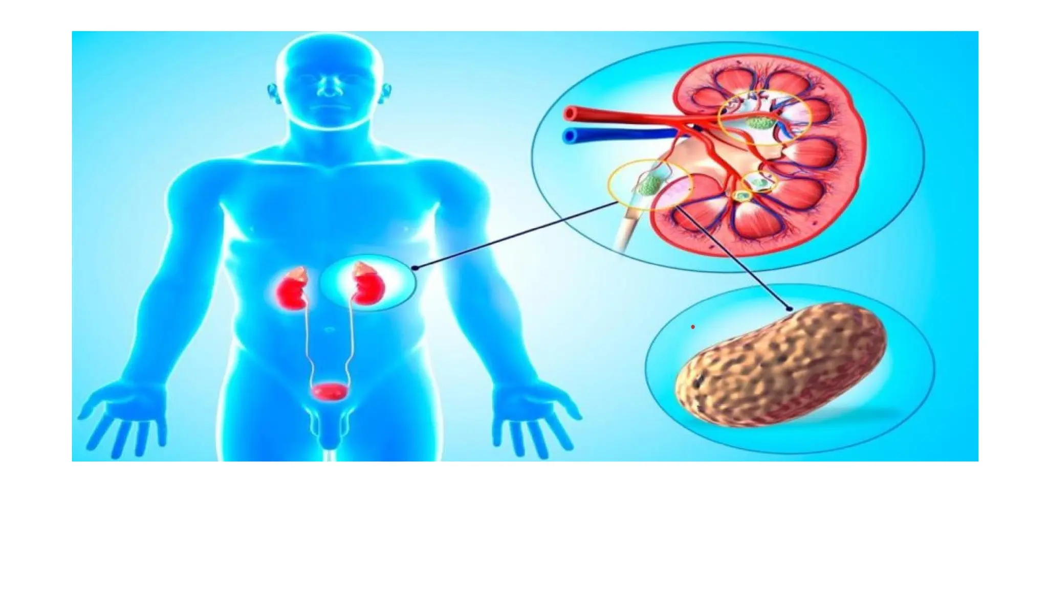 Update on Management of Urolithiasis.PPTX