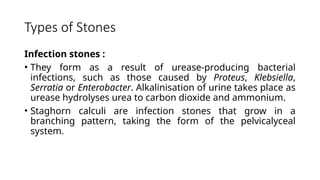 UROLITHIASIS INTRODUCTION, CLINICAL FEATURES AND MANAGEMENT | PPTX