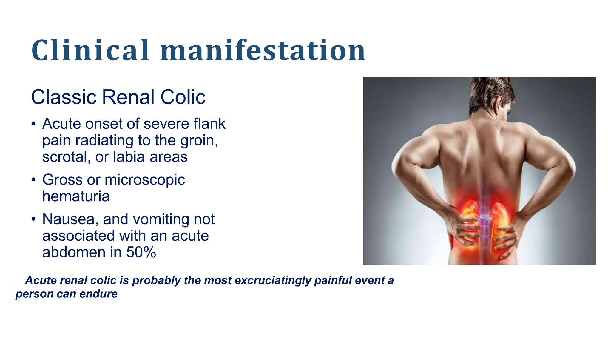 urolithiasis-by-dr-yasir.pptx