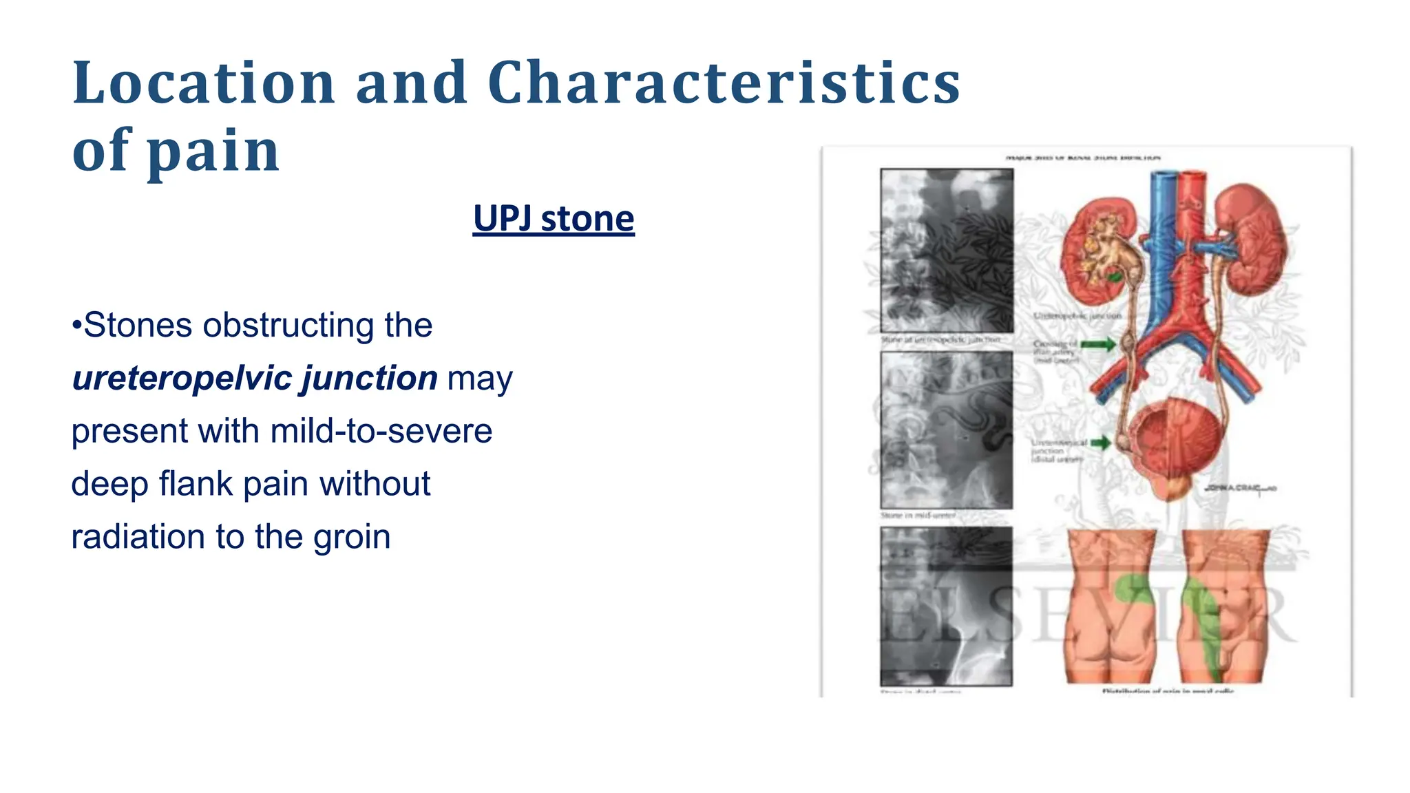 urolithiasis-by-dr-yasir.pptx