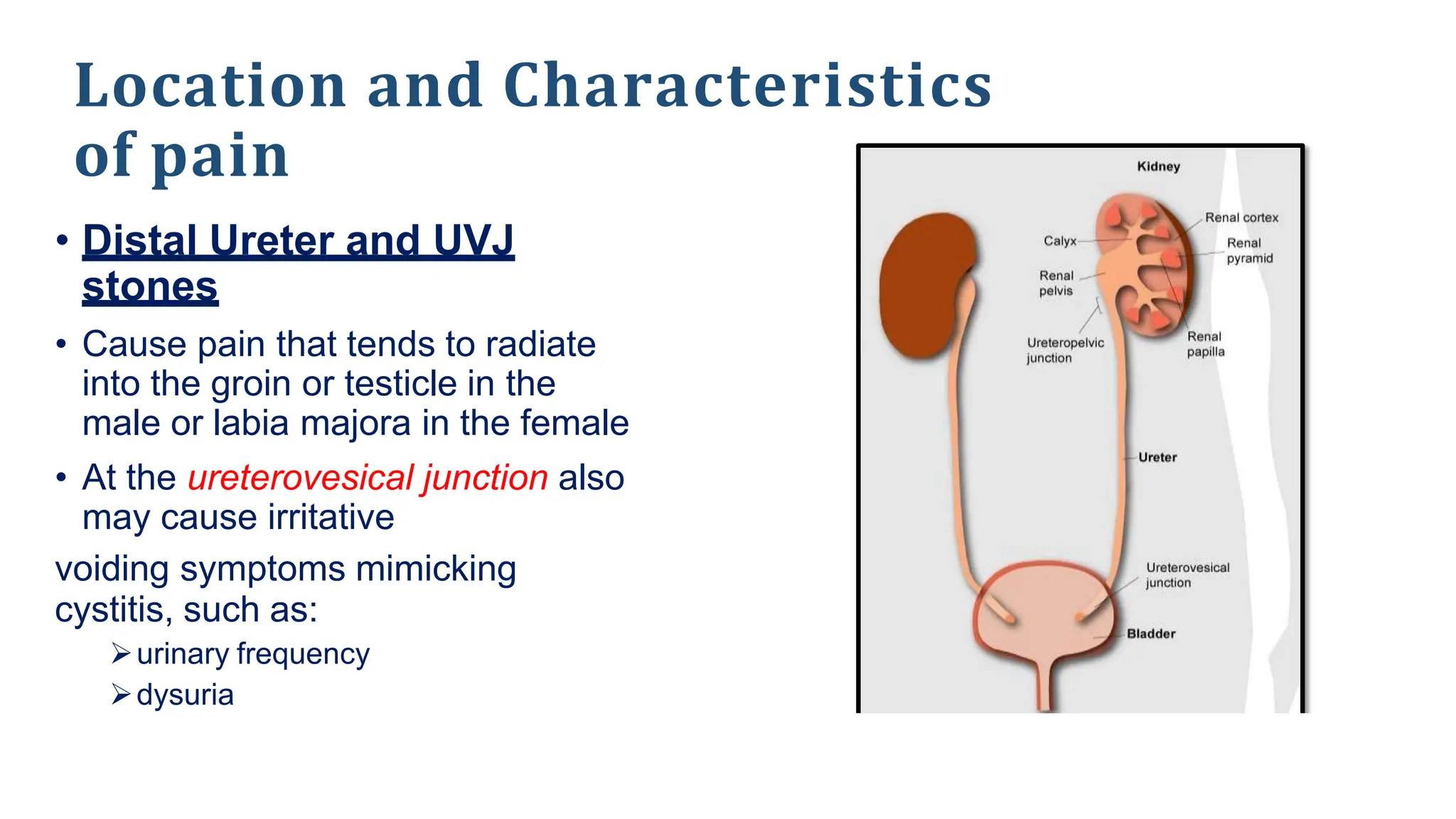 urolithiasis-by-dr-yasir.pptx