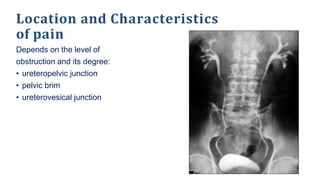 urolithiasis-by-dr-yasir.pptx