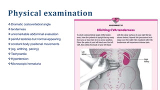urolithiasis-by-dr-yasir.pptx