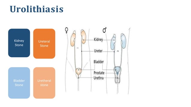 urolithiasis-by-dr-yasir.pptx | Digestive Disorders | Diseases and ...