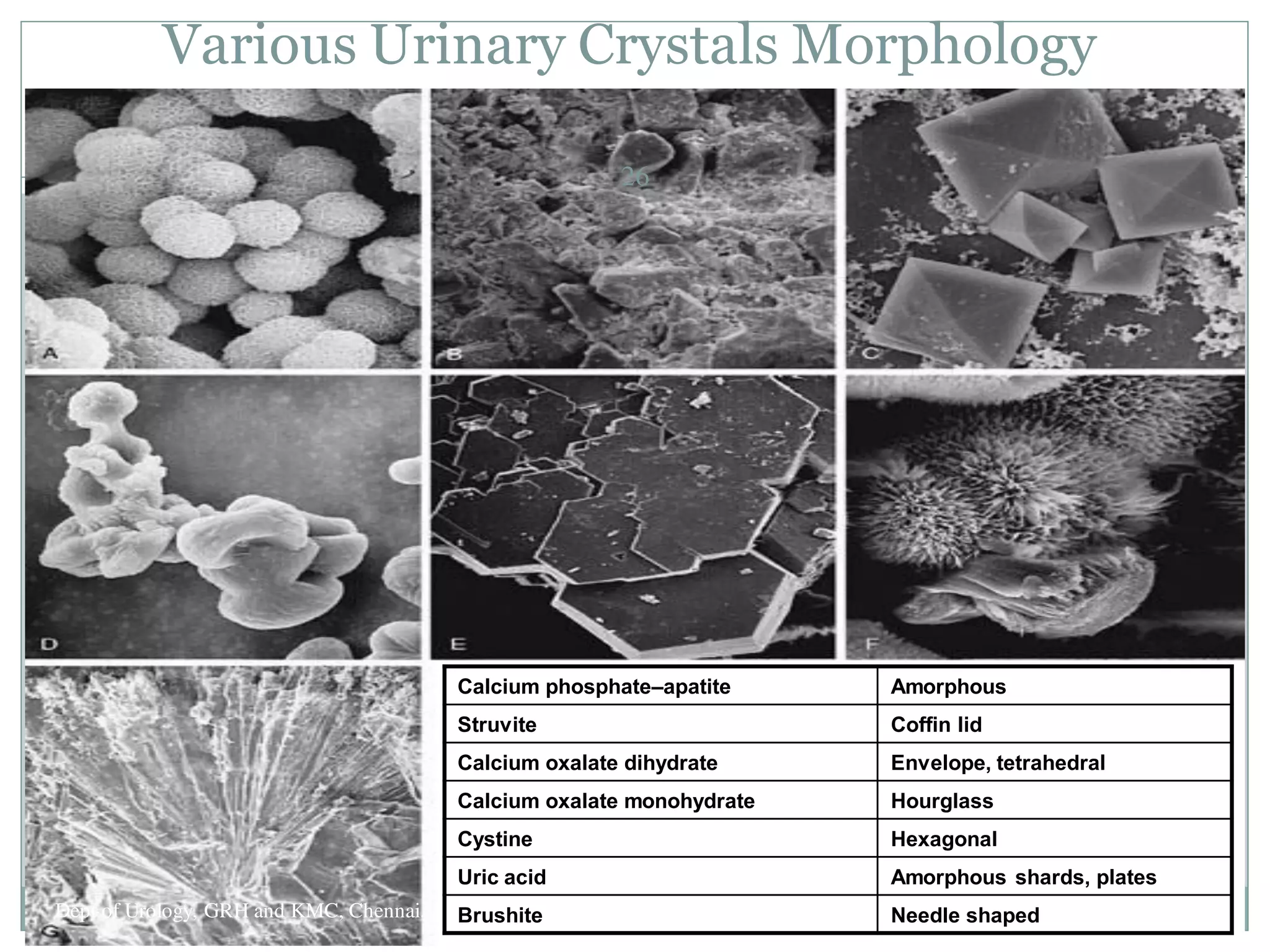 Urolithiasis evaluation | PPT