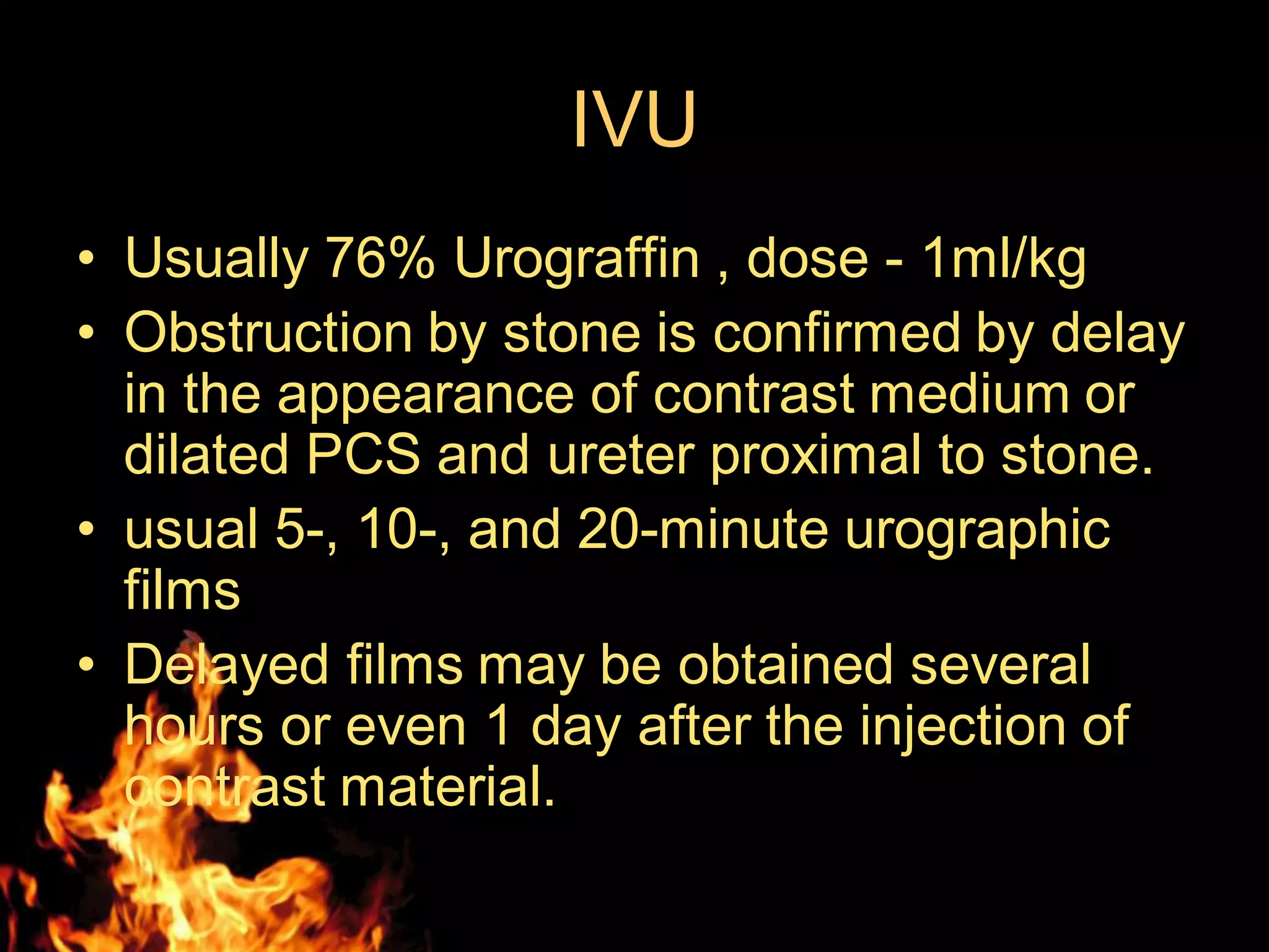 Urolithiasis evaluation and management brief | PDF